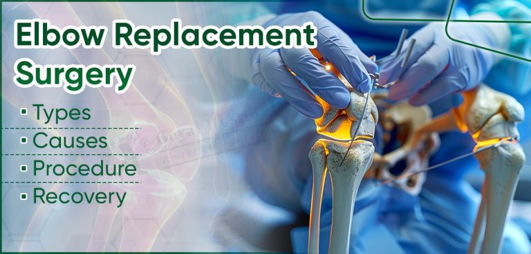 Elbow Replacement Surgery: Types, Causes, Procedure & Recovery