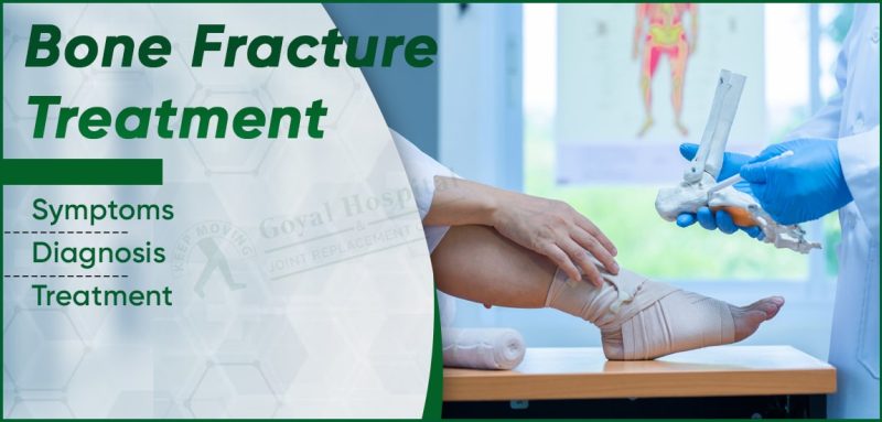 Bone Fracture Treatment: Symptoms, Diagnosis, Healing tips - Goyal Hospital